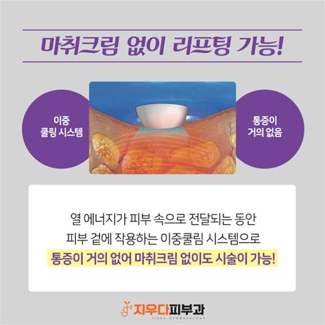 달서구피부과 전문의 진료주름 탄력 회복에 좋은 울쎄라 리프팅 네이버 블로그