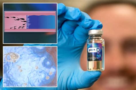 New Male Contraceptive Is Reversible Blocks Sperm With Injection