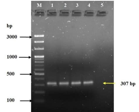 Prevalence Of Some Virulence Genes Among P Aeruginosa Isolates From