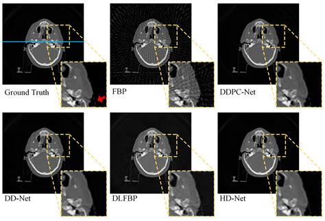 Learning From Projection To Reconstruction A Deep Learning