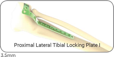 Prox Lat Tib I Austofix