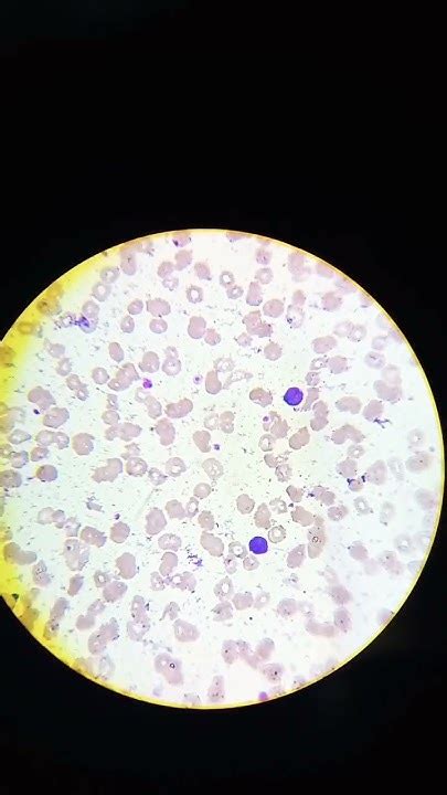 Morphology Of Lymphocytes At 100x Power Microscope 🙏🙏🙏🙏 Like And Subscribe Youtube