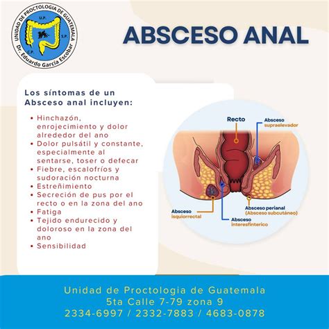 Unidad Un Absceso Anal Es Una Cavidad Infectada Llena De Pus Cerca Del Ano O El Recto Hay