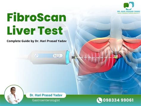 Fibroscan Liver Test In Indore Guide By Dr Hari Prasad Yadav