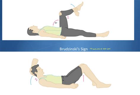 Lumbar Puncture Flashcards Quizlet Lumbar Puncture Flashcards Quizlet