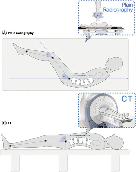 Schematic Illustrations Of Positions When Obtaining Plain Radiography