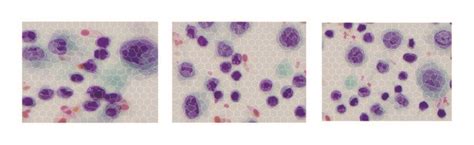 Visual Results Of Segmenting Cell Nuclei From Cpe Images A Original