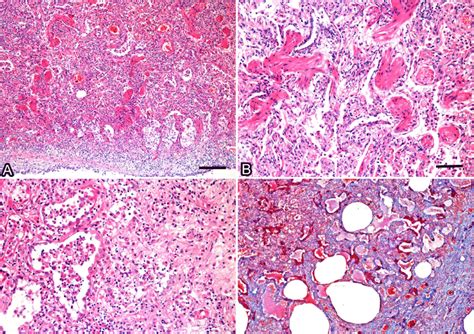 Lung Macrophages Histology