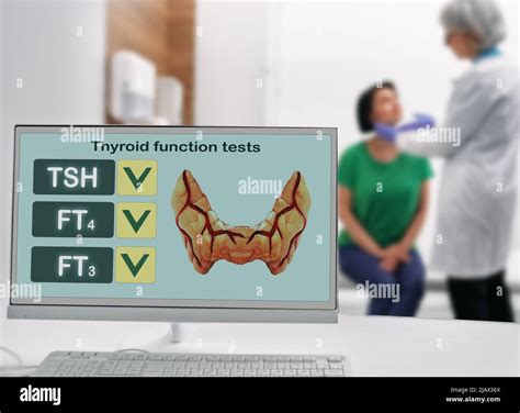 Monitor With Thyroid Illustration On The Doctor S Table From Behind Endocrinologist Checking