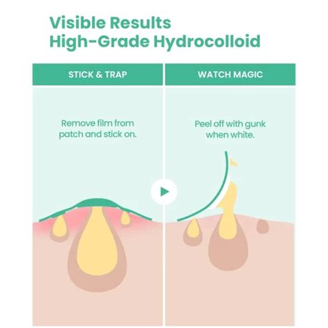 Shop Glam Up Spotless Nose Patch Hydrocolloid