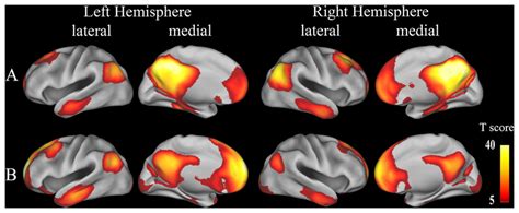 The Rsfc Maps Of The Right Pcc And Left Msfg One Sample T Test Fwe P
