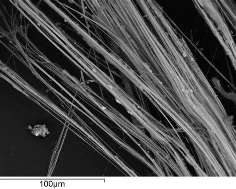 Asbestos Fibers Under Microscope
