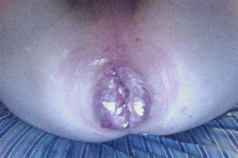 Pumped Ass Lips Porn Pictures Xxx Photos Sex Images 611849 Pictoa