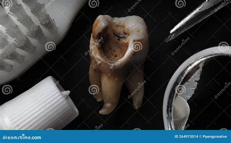 Macro Shot Of A Decayed Teeth Till Root After Extraction Of Dentist