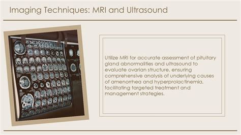 Amenorrhea Hyperprolactinemia Ppt Designs Acp Ppt Sample