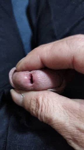 Phimosis Porn Videos Free Sex Movies On Got Porn