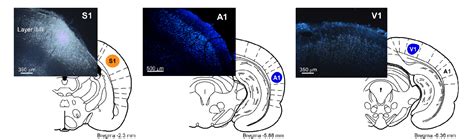 Figure 1 From Basal Forebrain Nuclei Display Distinct Projecting
