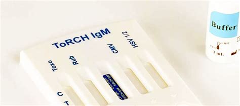 Prosedur Dan Biaya Tes Torch Untuk Ibu Hamil Daftar Harga And Tarif 2023