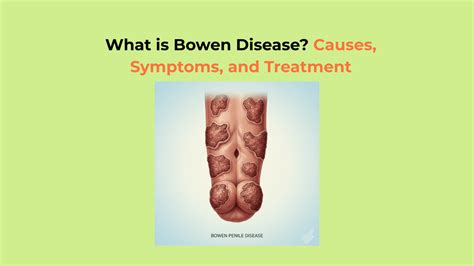 What Is Bowen Disease Of The Penis A Guide To Causes Symptoms And