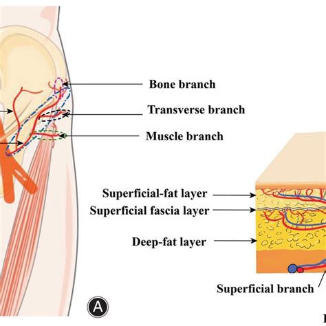 A The Anatomy And Design Of The Inguinal Donor Area B The Scip