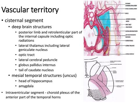 Anterior Choroidal Arterypptx