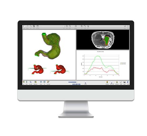 Imaging And Spatial Analysis Service Excellence By Kinetic Vision