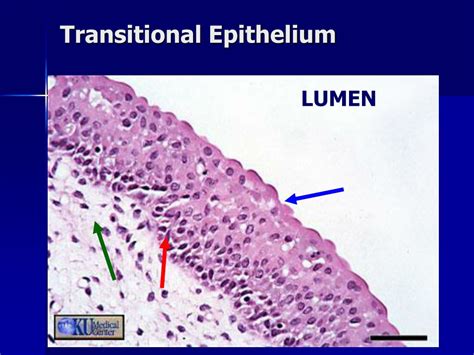 Transitional Epithelium