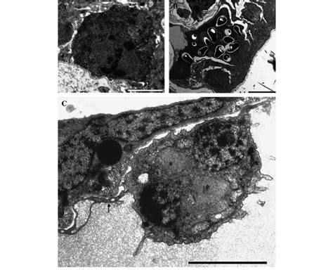 A Binucleate Cell In Recess Between Vascular Endothelial Cells The