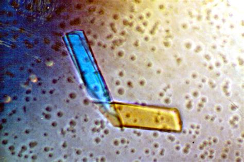 Revolucionando Medicina Con Anticuerpos Monoclonales Biology