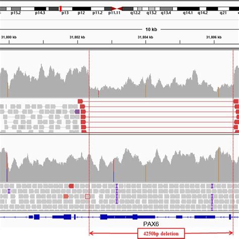 Comparison Of High Throughput Sequencing Between Affected And
