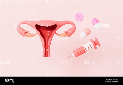 Uterine Diseases And Drug Therapy Female Gynecological Diseases 3d