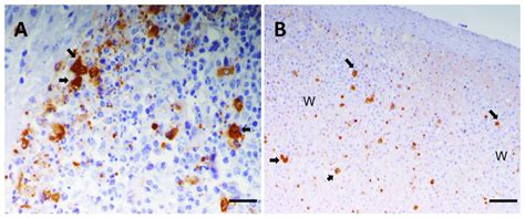 Immunohistochemical Detection Of Asfv Protein P30 On Wax Embedded