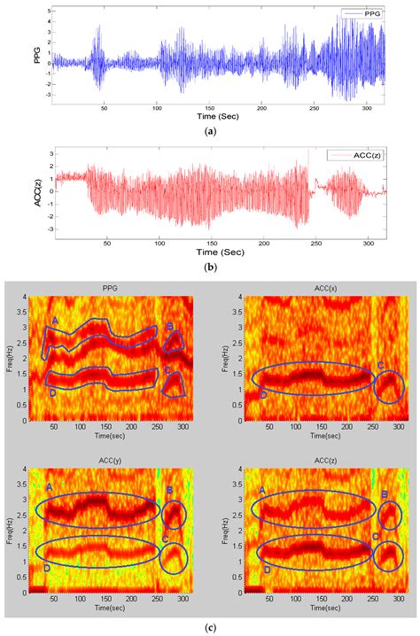 A Novel Time Varying Spectral Filtering Algorithm For Reconstruction Of Motion Artifact