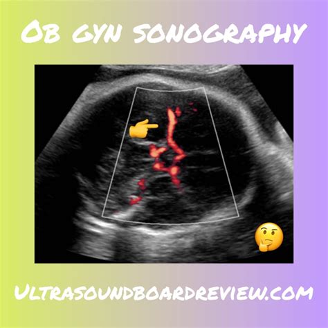 🔹ob gyn sonography board review ultrasound board review
