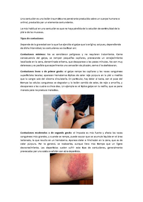 Constusiones Que Es La Constusion Una Contusión Es Una Lesión