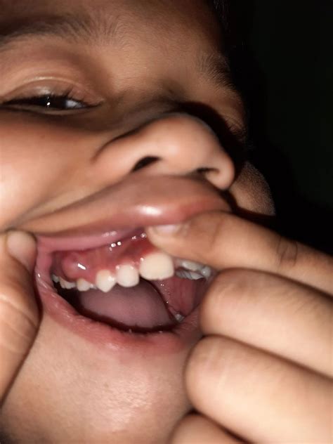 Simran Agrawal On Linkedin R