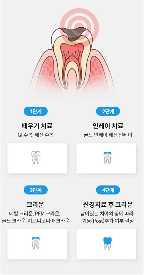 충치치료 다산 아우름 치과의원