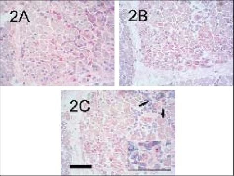 A C Serial Staining For Ifn γ Inos Cxcr4 And Tgf β In Representative