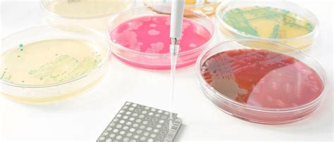 What Is The Purpose Of Microbiological Testing What Types Of Tests Are Included