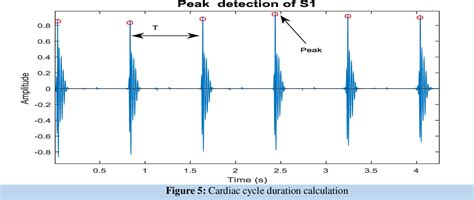 Figure 5 From The Impact Of Murmurs Severity On The Cardiac Variability Semantic Scholar