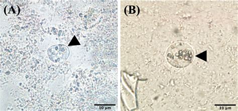 Figure 2 From Investigation Of Dientamoeba Fragilis Prevalence And