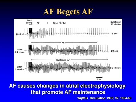 Ppt Cardioversion Of Atrial Fibrillation Clinical Issues Powerpoint