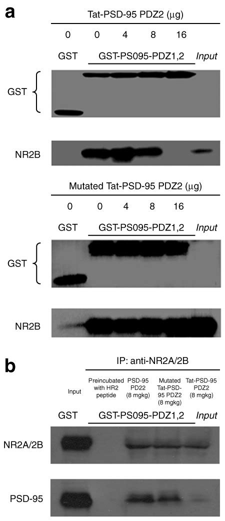 Disruption Of N Methyl D Aspartate Receptor Nmdar Psd 95 Protein Download Scientific Diagram