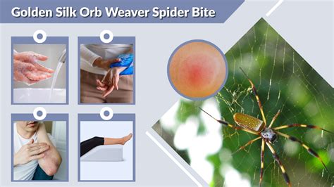 Golden Silk Orb Weaver Spider Bite Symptoms Reactions And First Aid