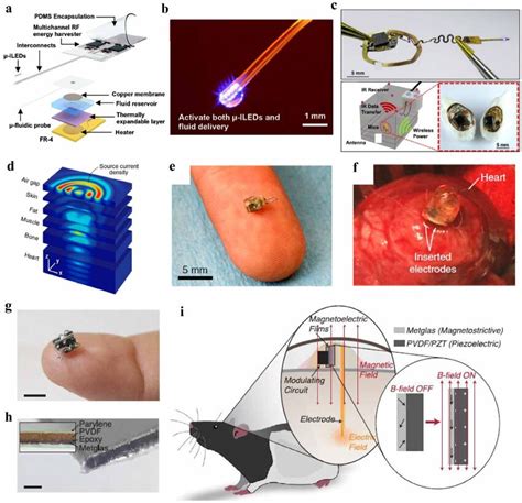 Wireless Neural Implants Through Electromagnetic Power Transfer A Download Scientific