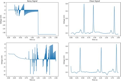 Example Of Noisy Signals Left And High Quality Signals Right Download Scientific Diagram