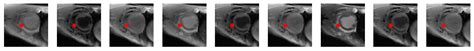 Pca Based Metrics For T1 Mapping · Issue 991 · Superelastixelastix