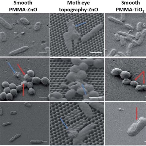 Comparative Sem Imaging Of The Bacteria Topography Interaction Of S Download Scientific