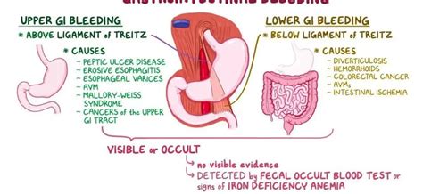 Bleeding From The Upper Gastrointestinal Tract Healthy Food Near Me