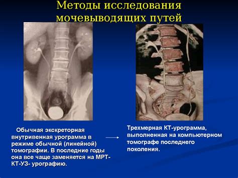Методы диагностики в рентгенологии Лекция 2 презентация онлайн